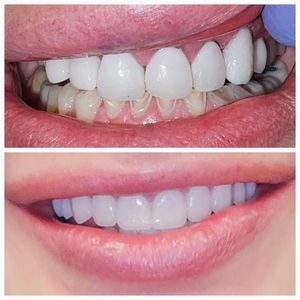 BIONIC SMILE - Updated May 2025 - 359 Photos & 10 Reviews - 4416 S ...