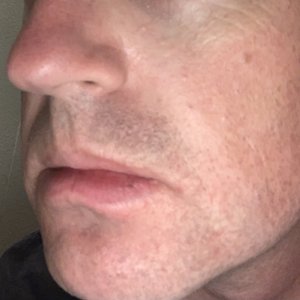 EVAN RANSOM, MD - 101 Photos & 164 Reviews - Cosmetic Surgeons - 450 ...