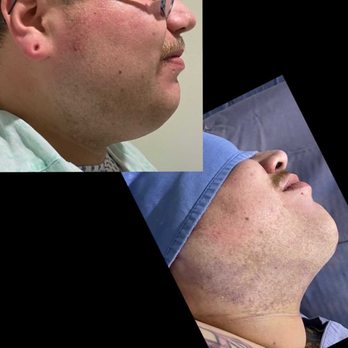 SPLENDHERE - Updated December 2025 - 17 Photos & 11 Reviews - Blvd ...