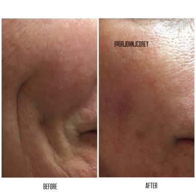 JOHN J. COREY, MD - AESTHETIC PLASTIC SURGERY - Updated December 2025 ...