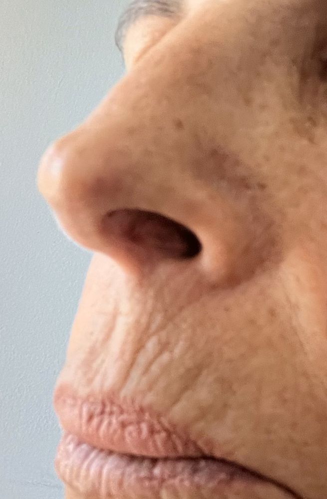 PATRICK CLEVELAND FACIAL PLASTIC SURGERY - Updated July 2024 - 10 ...