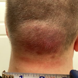 HELEN M TOROK, MD - TRILLIUM CREEK DERMATOLOGY - Updated June 2025 ...