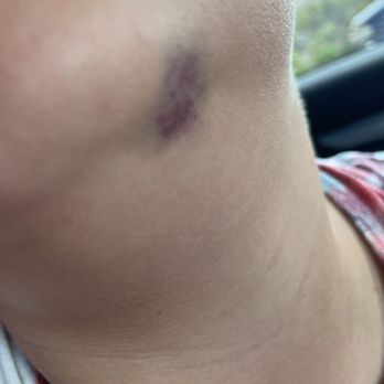 THE RINKS IRVINE INLINE - Updated July 2025 - 84 Photos & 69 Reviews ...