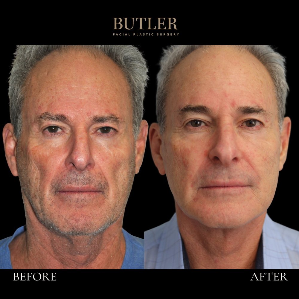 BUTLER FACIAL PLASTIC SURGERY - Updated October 2025 - 41 Photos - 2001 ...