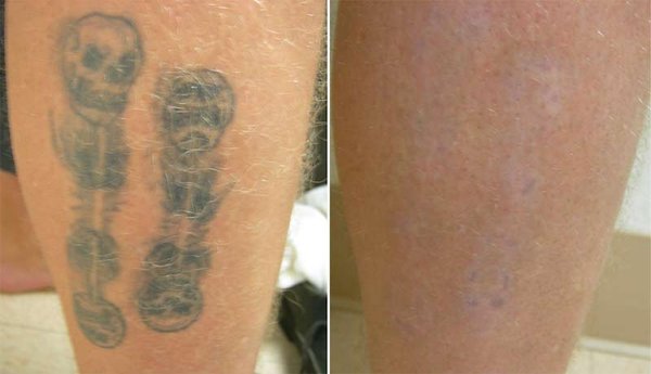 TIMOTHY M JOCHEN, MD - Updated December 2025 - 43 Photos & 219 Reviews ...