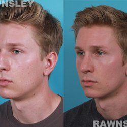JEFFREY RAWNSLEY, MD - RAWNSLEY PLASTIC SURGERY - 61 Photos & 67 ...