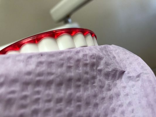 DIAMOND DENTAL - Updated January 2026 - 43 Photos & 54 Reviews - 2790 ...