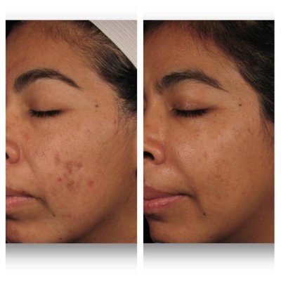 PRISTINE SPA - Updated July 2024 - 29 Photos & 21 Reviews - 3374 Canoe Creek Rd, Saint Cloud ...