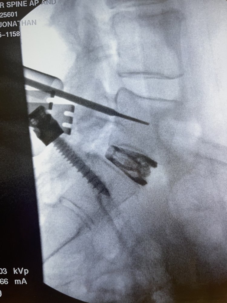 ADVANCED NEUROSURGERY - Updated November 2024 - 10496 Montgomery Rd ...