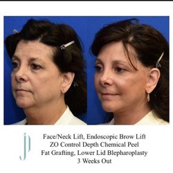 JOHN PARK MD PLASTIC SURGERY - 94 Photos & 74 Reviews - 180 Newport ...