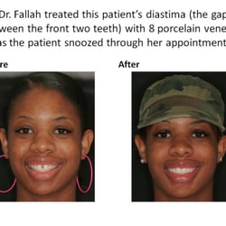 AL A FALLAH, DDS - 29 Photos & 28 Reviews - General Dentistry - 1293 ...