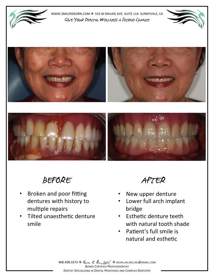 KEVIN C LIN, DDS, FACP - Updated October 2025 - 13 Reviews - 333 W ...