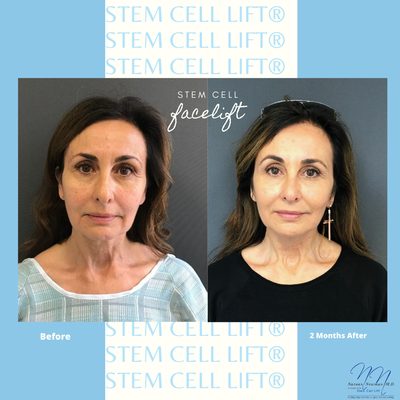 NATHAN NEWMAN, MD - Updated August 2025 - 24 Photos & 48 Reviews - 9301 ...