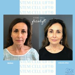 NATHAN NEWMAN, MD - 24 Photos & 19 Reviews - 9301 Wilshire Blvd ...