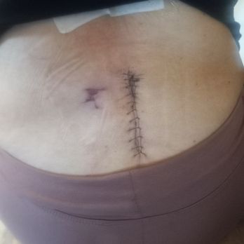 MOKSHA RANASINGHE, MD - Updated October 2025 - 22 Reviews - 101 E ...