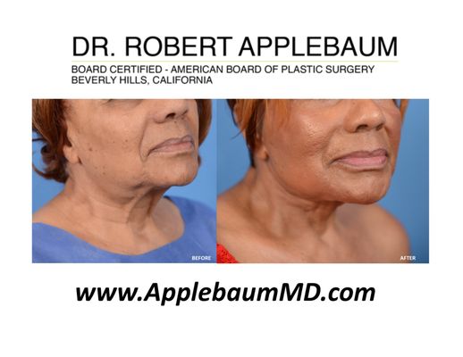 ROBERT APPLEBAUM, MD - Updated October 2025 - 26 Photos & 54 Reviews ...