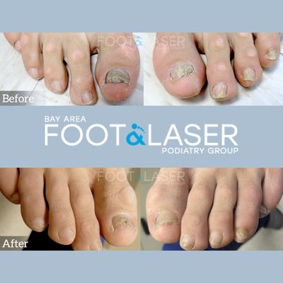 BAY AREA FOOT & LASER PODIATRY GROUP - WALNUT CREEK - Updated October ...