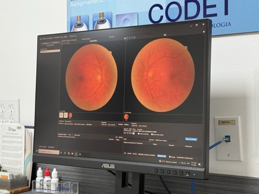 CODET VISION INSTITUTE - Updated September 2025 - 33 Photos & 51 ...