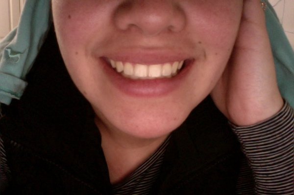 ROWAN ORTHODONTICS - Updated May 2026 - 19 Photos & 30 Reviews - 900 ...