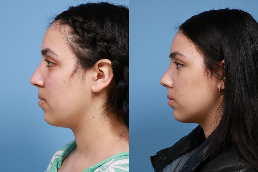 HUDSON FACIAL PLASTIC SURGERY - Updated January 2026 - Request an ...