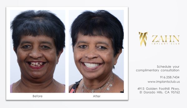 ZAHN IMPLANT CLUB - Updated January 2026 - 18 Photos - 4913 Golden ...