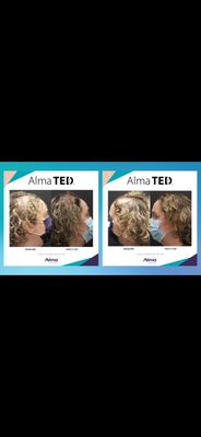 DECON - DIABETES & ENDOCRINE CENTER OF NEVADA - Updated December 2025 ...