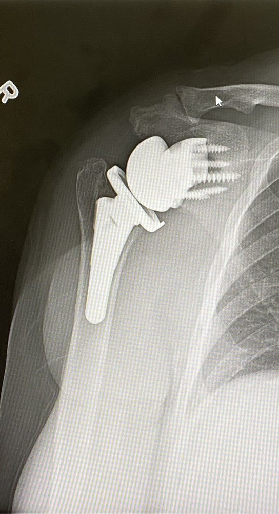 JOHN M ITAMURA, MD - KERLAN JOBE ORTHOPAEDIC GROUP - Updated May 2026 ...