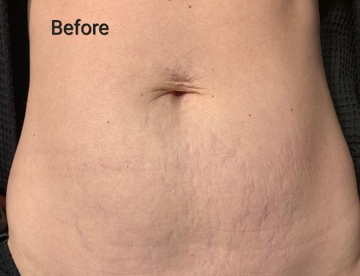 BRONZED BLISS TAN - Updated October 2025 - 45 Photos & 27 Reviews ...