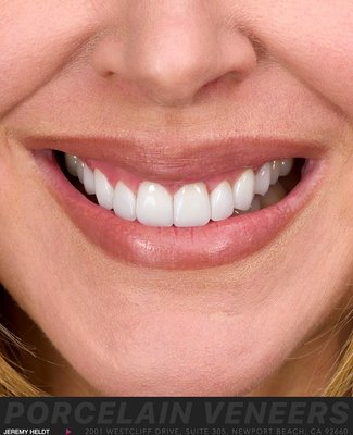 JEREMY HELDT, DDS - Updated December 2025 - 219 Photos & 104 Reviews ...