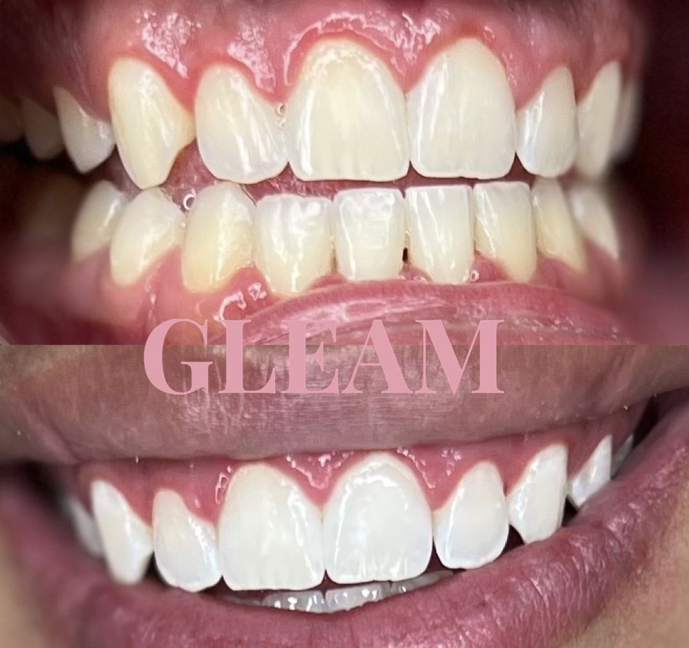 GLEAM - Updated April 2024 - 20 Photos - 5625 Woodrow Bean ...