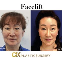 CK PLASTIC SURGERY - 177 Photos & 74 Reviews - Cosmetic Surgeons - 2970 ...