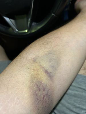 BIOLIFE PLASMA SERVICES - Updated July 2025 - 28 Photos & 55 Reviews ...