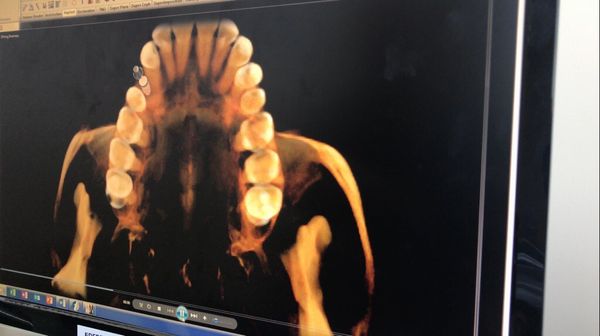 EL DORADO FAMILY DENTAL - Updated January 2026 - 25 Photos & 44 Reviews ...