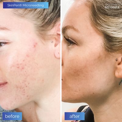 DERMANI MEDSPA - Updated December 2025 - 83 Photos & 68 Reviews - 5950 ...