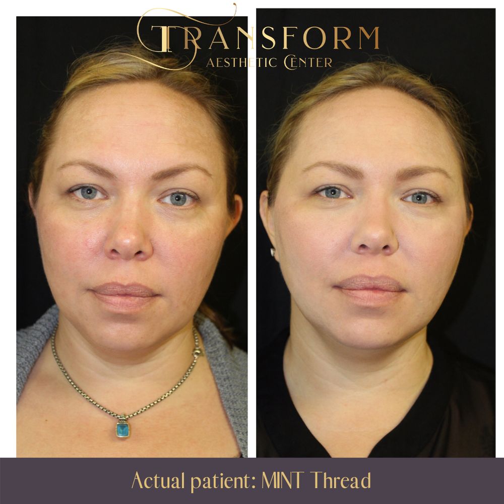 TRANSFORM AESTHETIC CENTER - 57 Photos - 821 Canal St, New Smyrna Beach ...