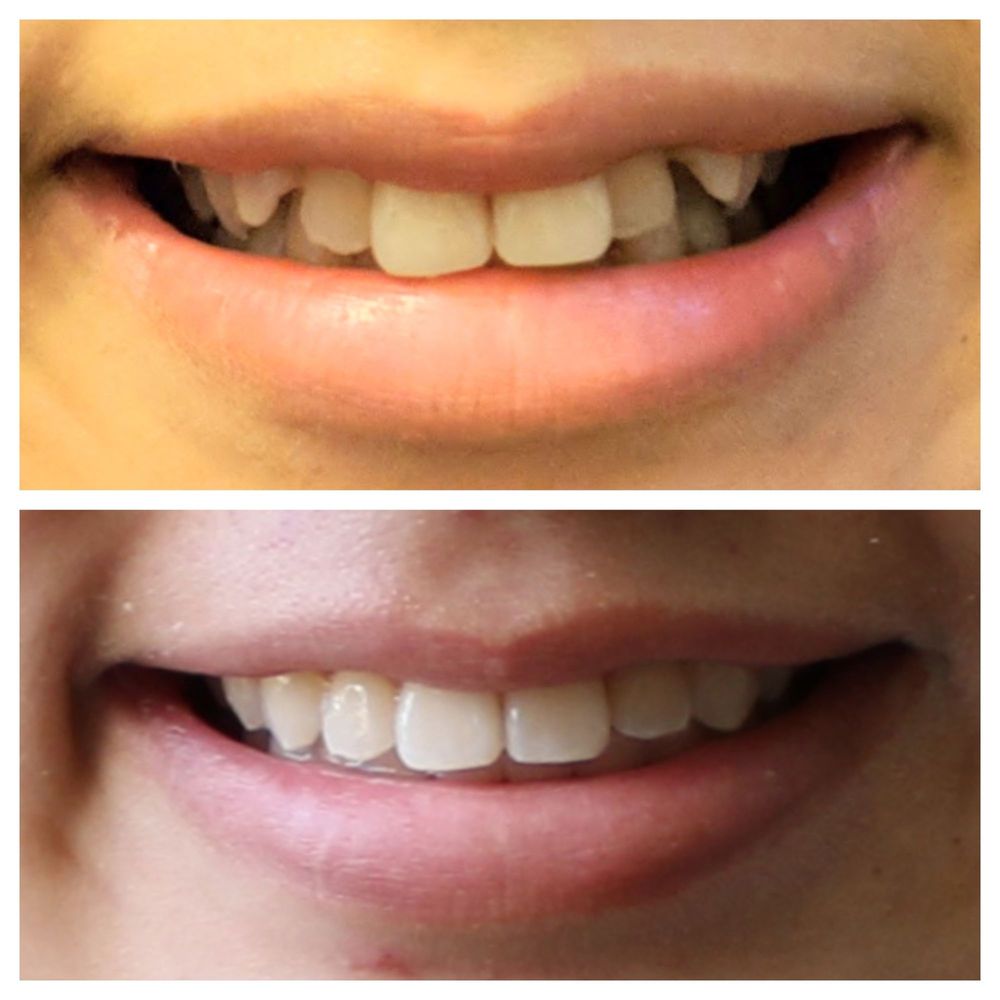 TRI-VALLEY ORTHODONTICS, DR. JESSE KO & DR. ANNE YOON - Updated July ...