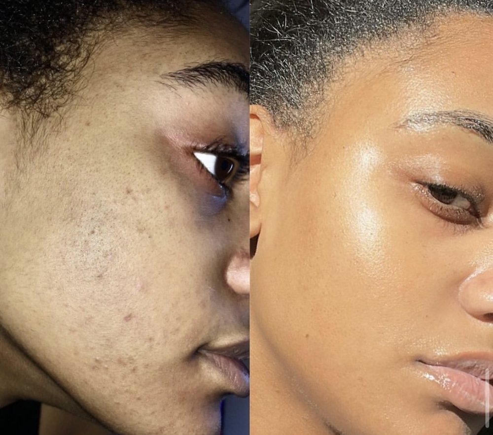 SKIN PLUG - Updated July 2024 - Request an Appointment - 2340 Dundas ...