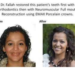 AL A FALLAH, DDS - 29 Photos & 28 Reviews - General Dentistry - 1293 ...