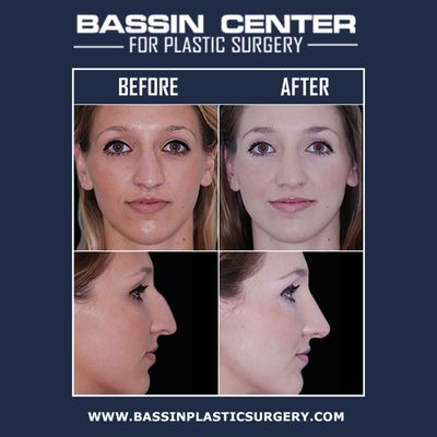 THE BASSIN CENTER FOR PLASTIC SURGERY - Updated January 2026 - 25 ...