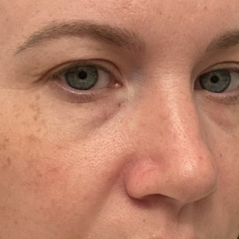 JEFFREY JOSEPH, MD - Updated December 2024 - 44 Photos & 91 Reviews ...