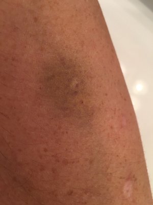 LABCORP - Updated May 2026 - 17 Photos & 86 Reviews - 2730 S Val Vista ...