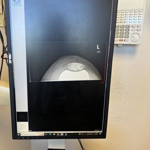 ERIK C SPAYDE, MD - Updated April 2025 - 18 Photos & 42 Reviews - 558 ...