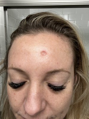 VALLEY SKIN INSTITUTE - Updated June 2026 - 25 Photos & 57 Reviews ...