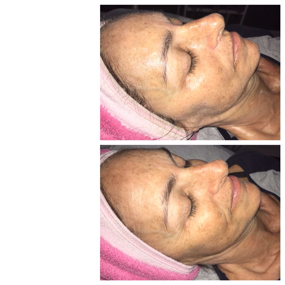 INFINI SKIN BY PRYSCILLA - Updated August 2025 - 13 Photos - 809 ...