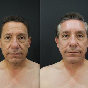 VIVE PLASTIC SURGERY - Updated March 2025 - 76 Photos & 66 Reviews - Av Salvador Novo 1060 ...