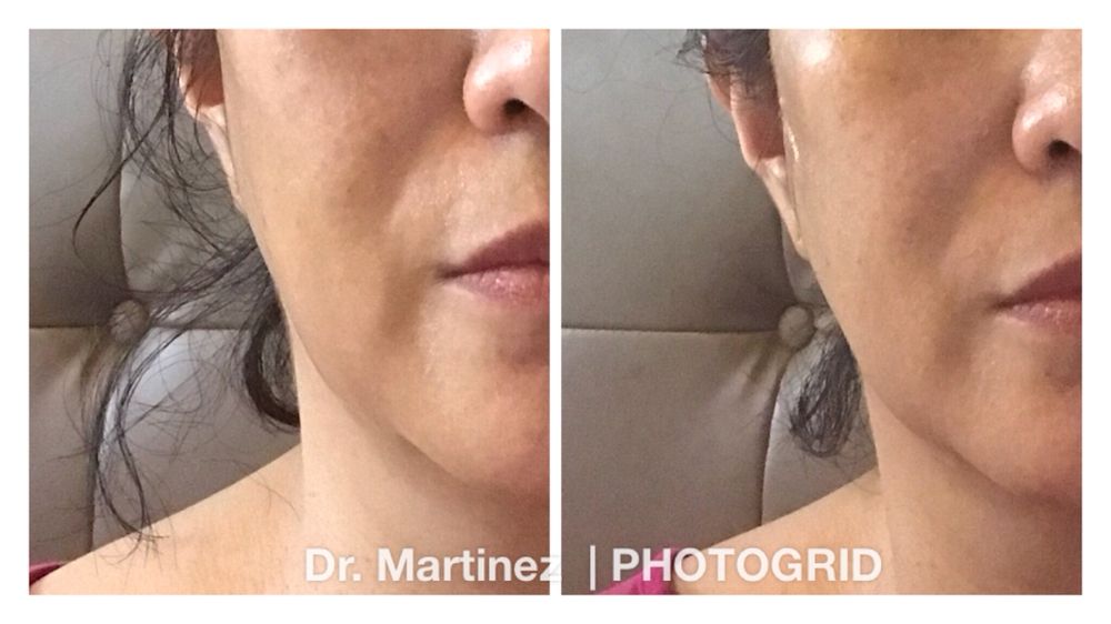 SKIN LASER MANILA - Updated May 2026 - 12 Photos - Rizal Avenue, 32nd ...