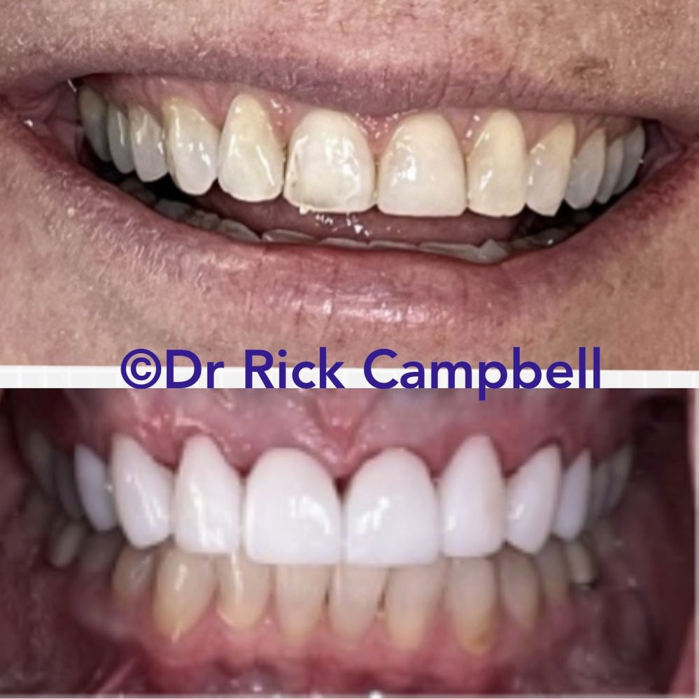 RICK CAMPBELL, DDS-SUNRISE SMILE DESIGN - Updated December 2025 - 7227 ...