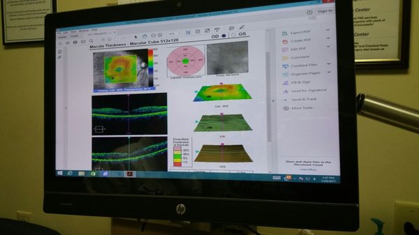 SOCAL EYE - Updated October 2025 - 26 Photos & 129 Reviews - 3300 E ...