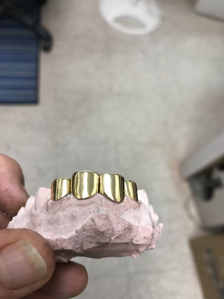 GOLD TEETH OF BATON ROUGE - Updated August 2025 - 26 Photos - 1119 ...