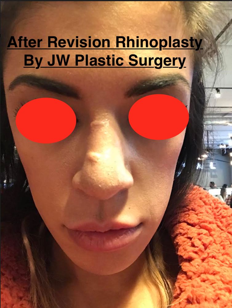 JW PLASTIC SURGERY - CLOSED - Updated May 2025 - 845 N Michigan Ave ...